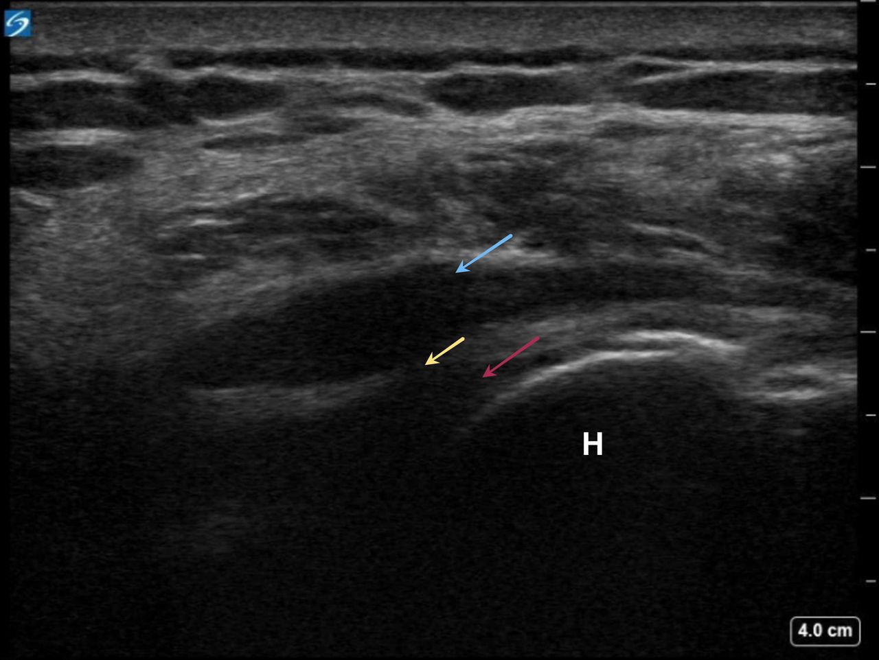 Utilisation of musculoskeletal ultrasonography for the evaluation of ...